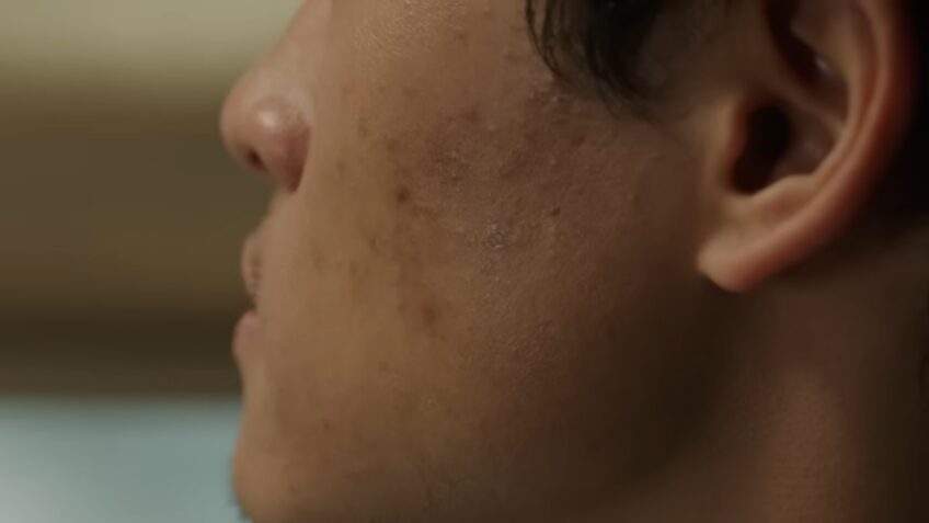 Side Effects of Testosterone Boosters - What They Can and Can't Do ...